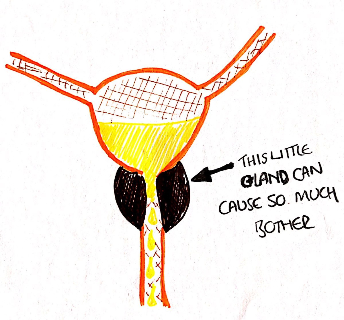 Male lower urinary tract symptoms (LUTS) – The GP trainee's survival guide